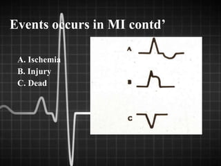 Acute myocardial-infraction | PPTX | Heart and Cardiovascular Diseases ...