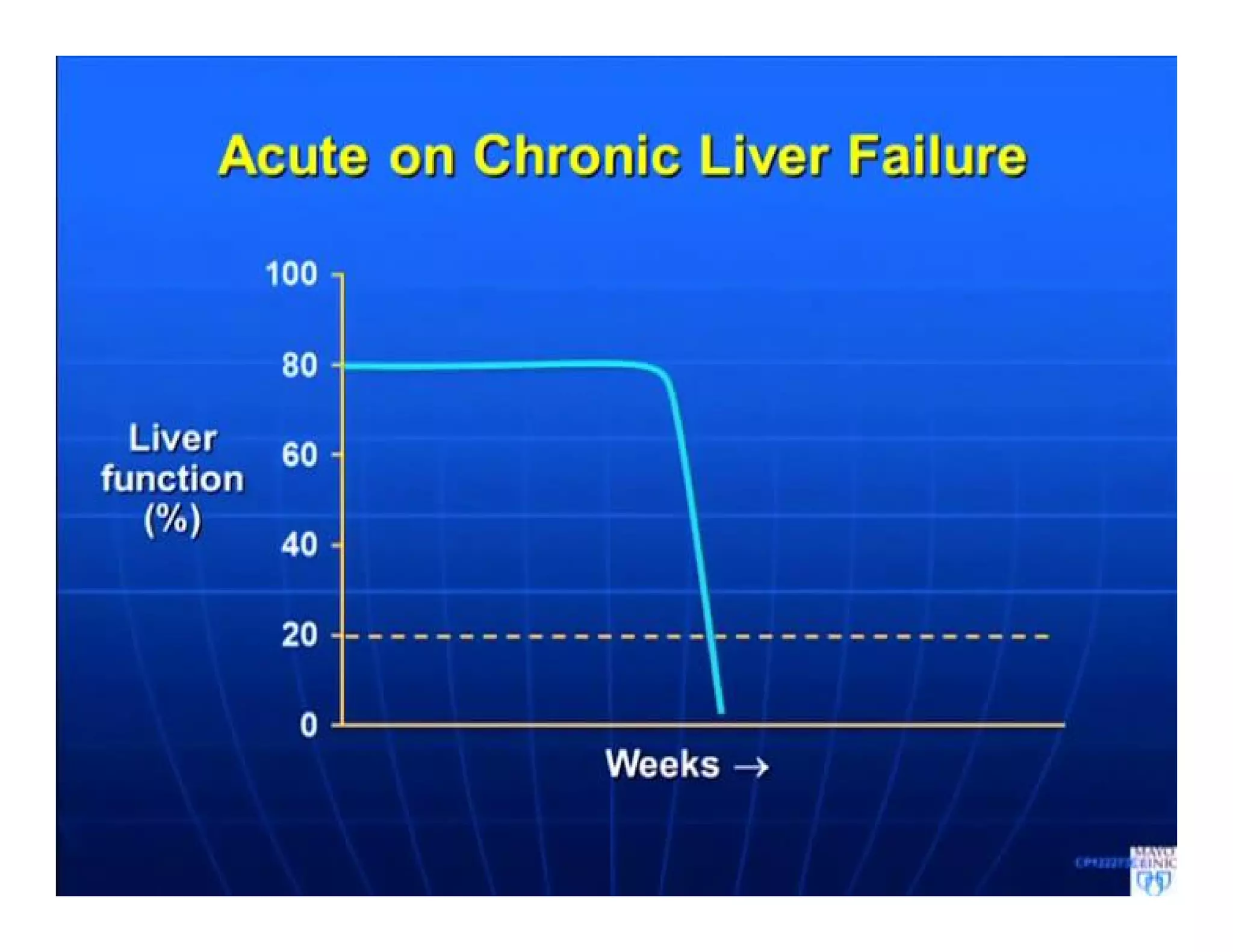 Acute on chronic liver failure | PDF