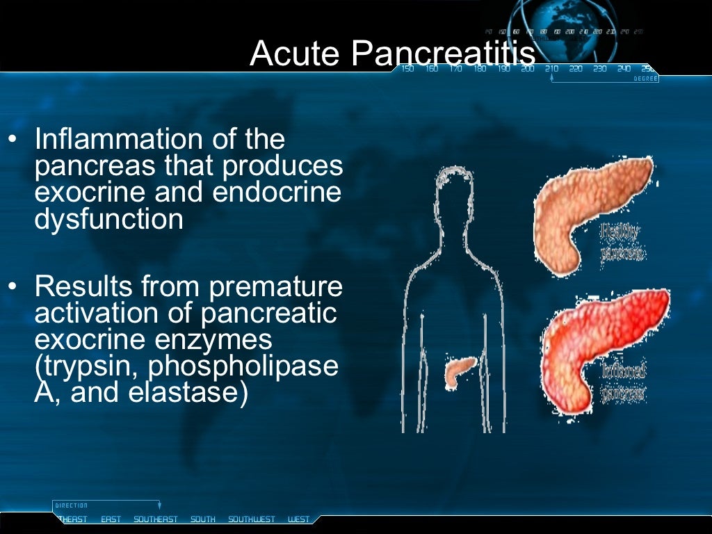 Acute pancreatitis