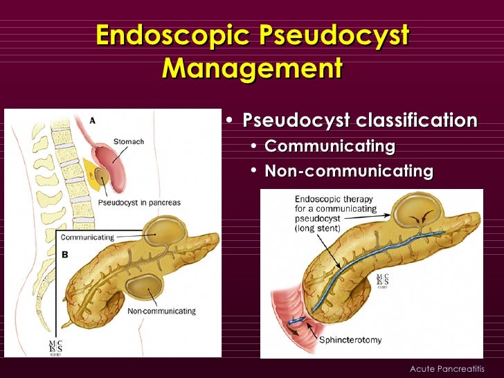 Acute Pancreatitis Management Conference