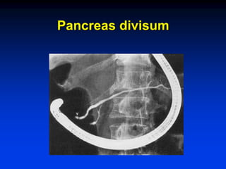 Acute-Pancreatitis copy 1.pptx