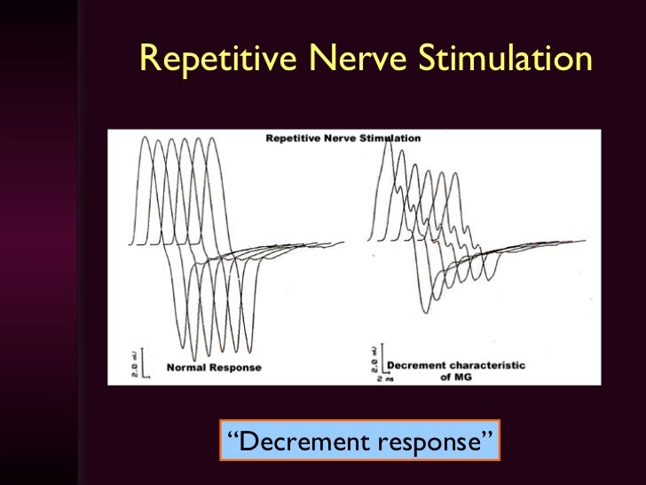 Acute Peripheral Neurologic disorder