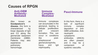 Acute-Postinfectious-Poststreptococcal-Glomerulonephritis.pptx