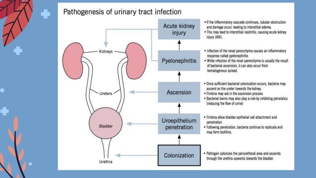 ACUTE-PYELONEPHRITIS in pediatrics in the philippines.pptx