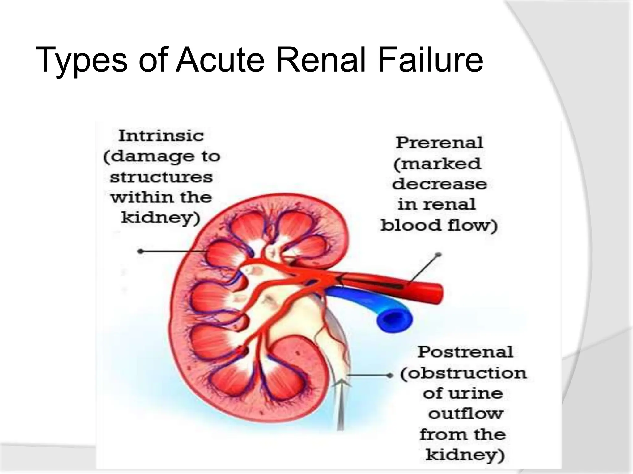 Acute-Renal-Failure-ppt.pptx