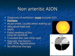 Acute-Visual-Loss-Emergency-Room-Perspective.ppt