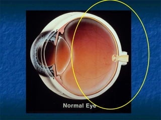 Acute-Visual-Loss-Emergency-Room-Perspective.ppt