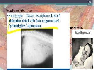 Clinical Differential diagnosis of Acute abdomen | PPTX