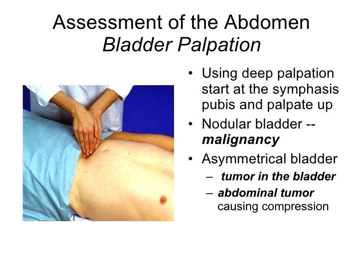 Acute Abdomen