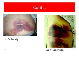 Acute abdomen | PPT | Digestive Disorders | Diseases and Conditions