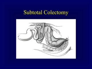Acute abdomen | PPT
