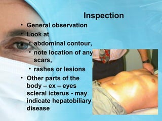 Acute abdomen | PPT