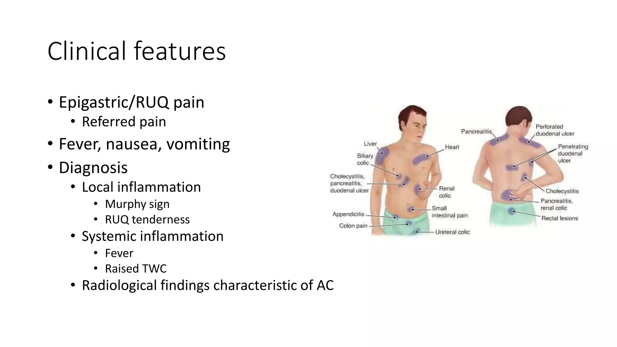 Acute abdomen | PPTX