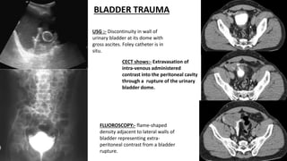 Acute abdomen | PPTX