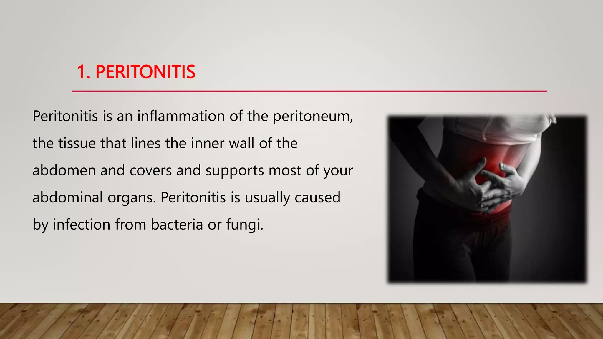 Acute abdomen.pptx