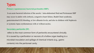 Acute abdomen.pptx