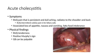 acute abdomen........................pptx