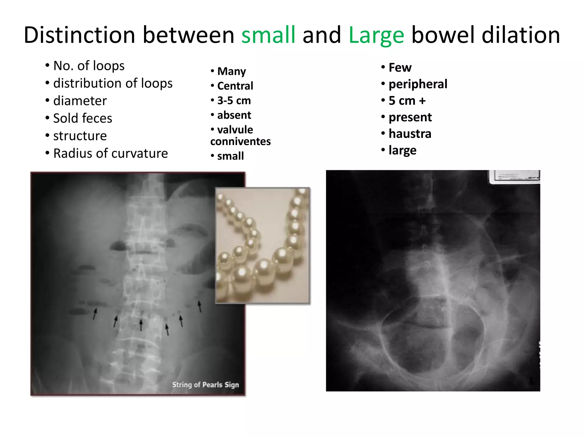 Acute abdomen a practical approach | PPTX
