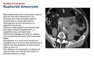 Acute abdomen a practical approach | PPTX