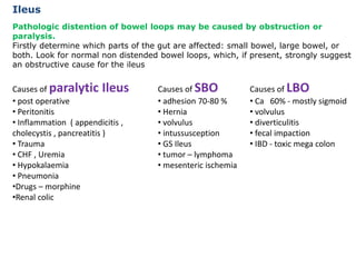 Acute abdomen a practical approach | PPTX