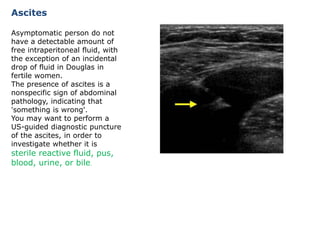 Acute abdomen a practical approach | PPTX