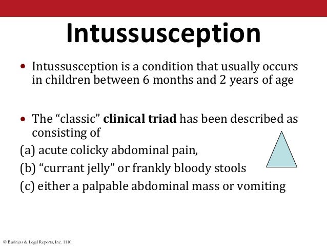 Acute abdomen dr.lalitha