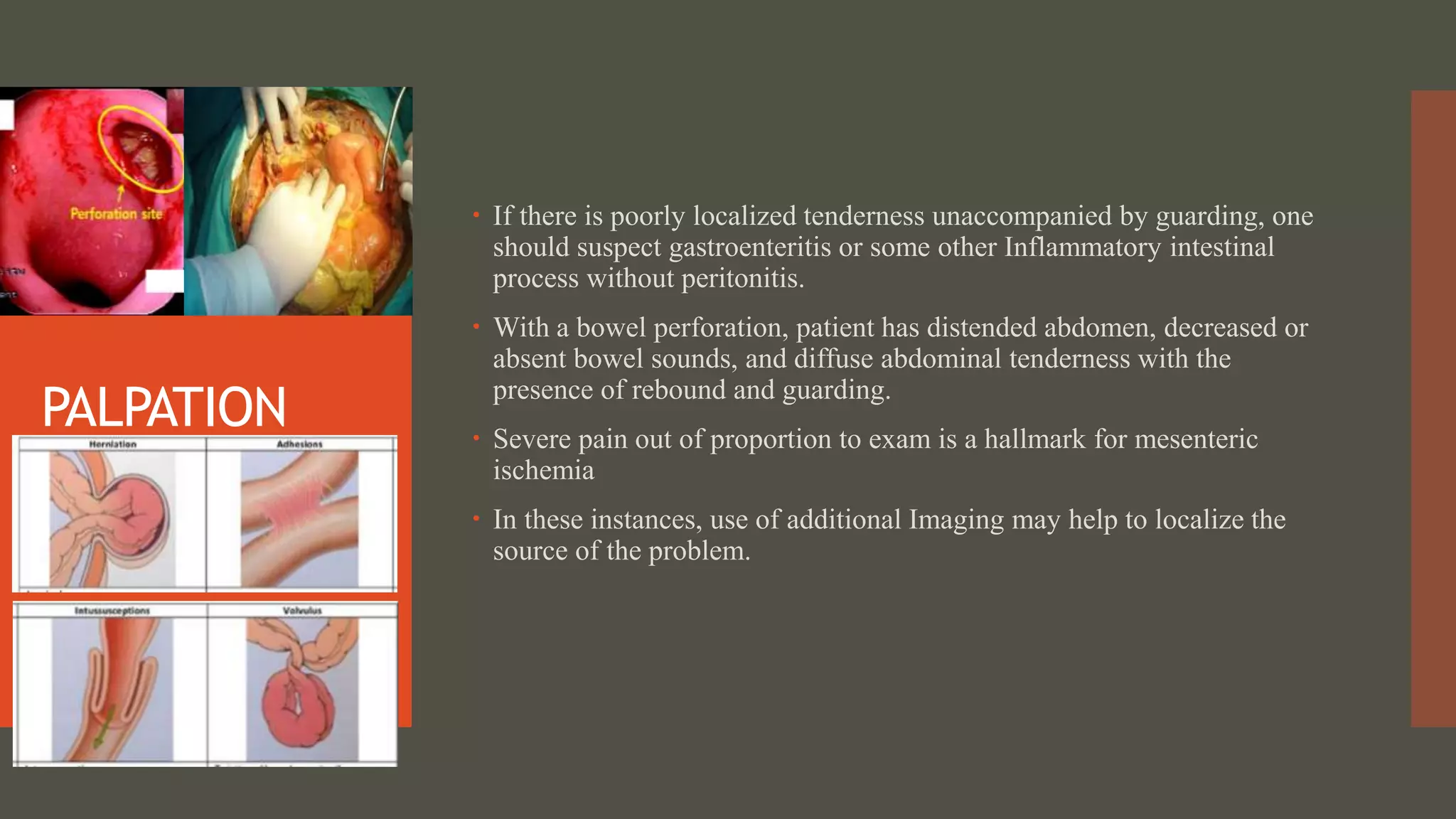 ACUTE ABDOMEN-PE.pptx