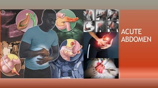 ACUTE ABDOMEN-PE.pptx