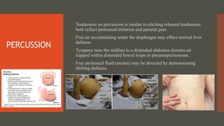 ACUTE ABDOMEN-PE.pptx