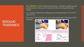 ACUTE ABDOMEN-PE.pptx