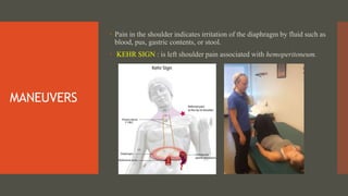 ACUTE ABDOMEN-PE.pptx