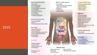 ACUTE ABDOMEN-PE.pptx