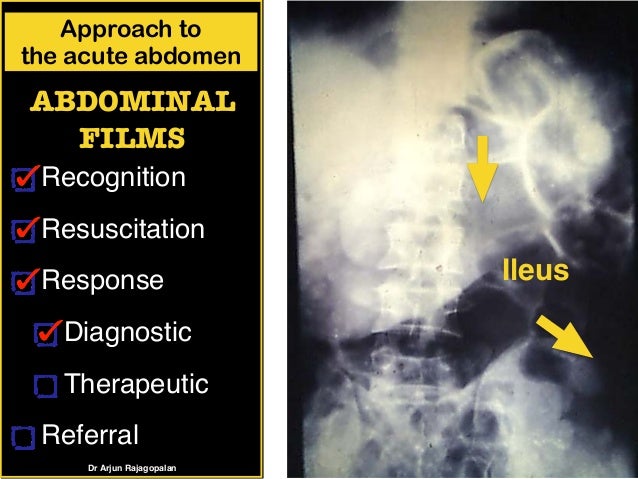 The Acute Abdomen A Process Based Approach