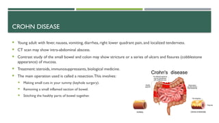 surgical causes of acute abdomen powerpoint | PPTX