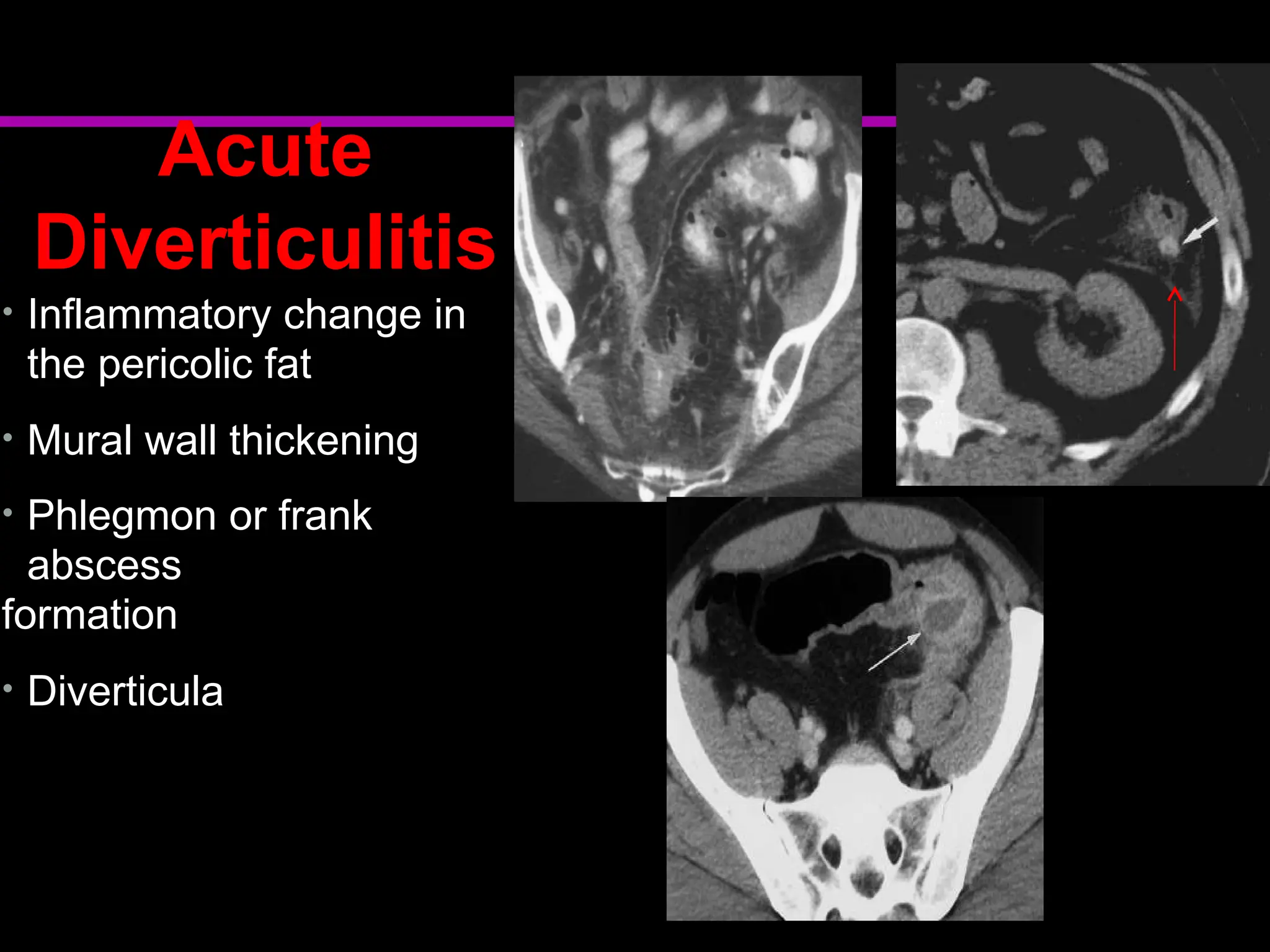 acute abdomen and imaging in trauma ug.ppt