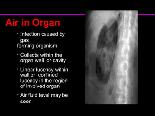 acute abdomen and imaging in trauma ug.ppt