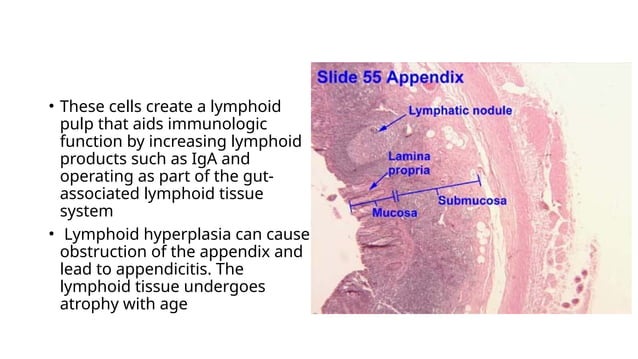 ACUTE ABDOMEN appendicitis AND peritonitis eden 2024.pptx