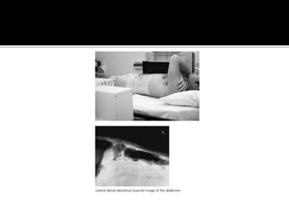 Acute abdomen for 4 sem.pptx