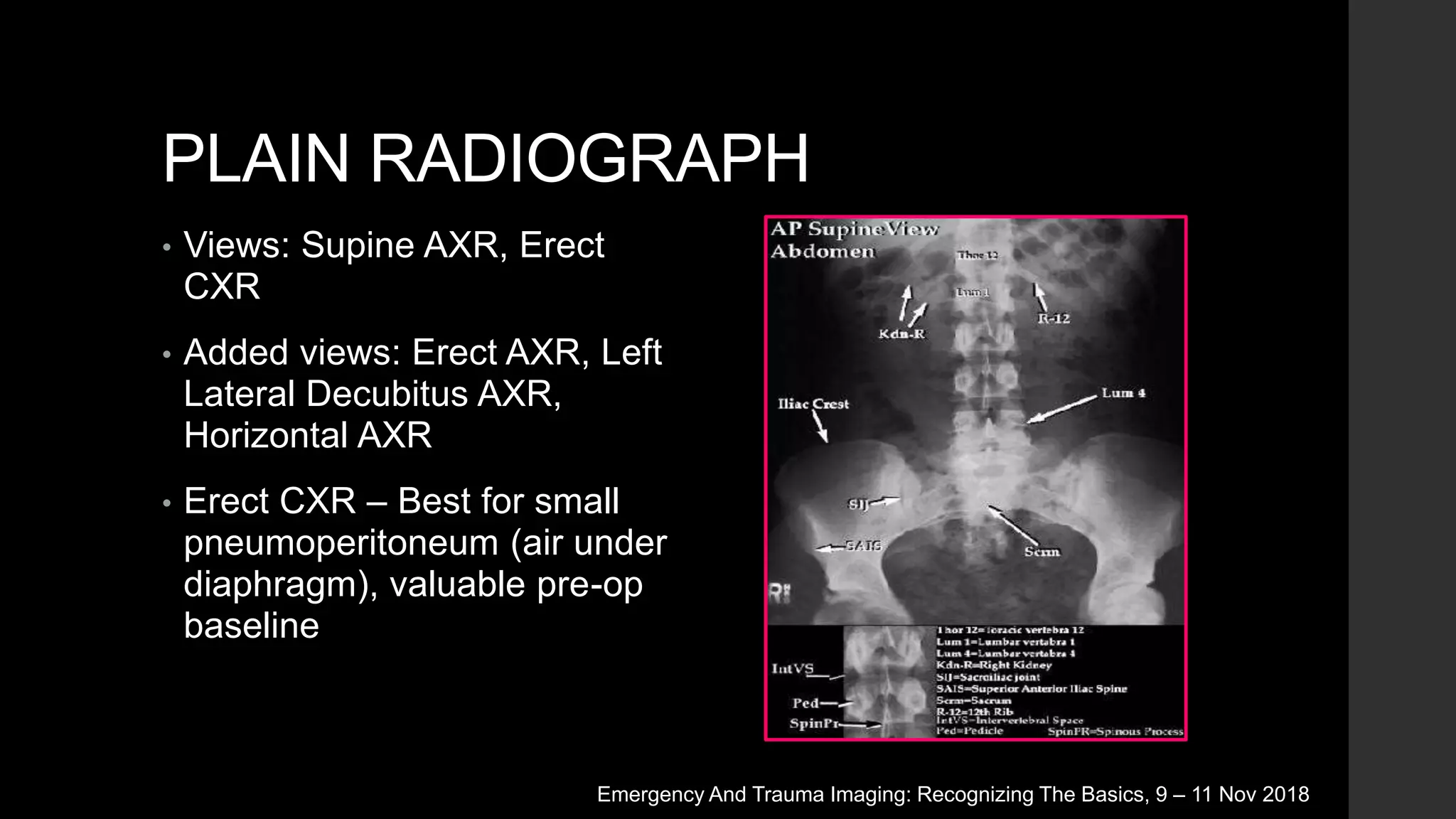 Acute Abdomen Imaging | PPTX