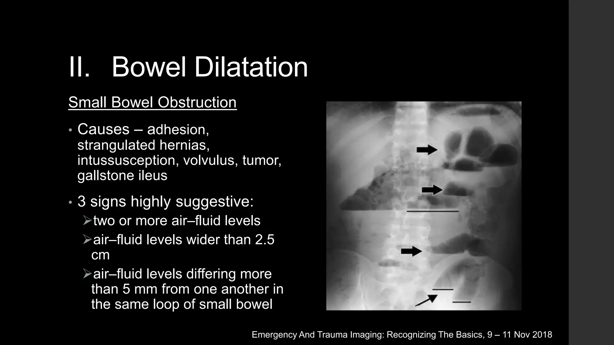Acute Abdomen Imaging | PPTX