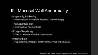 Acute Abdomen Imaging | PPTX