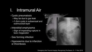 Acute Abdomen Imaging | PPTX