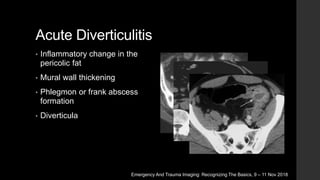 Acute Abdomen Imaging | PPTX