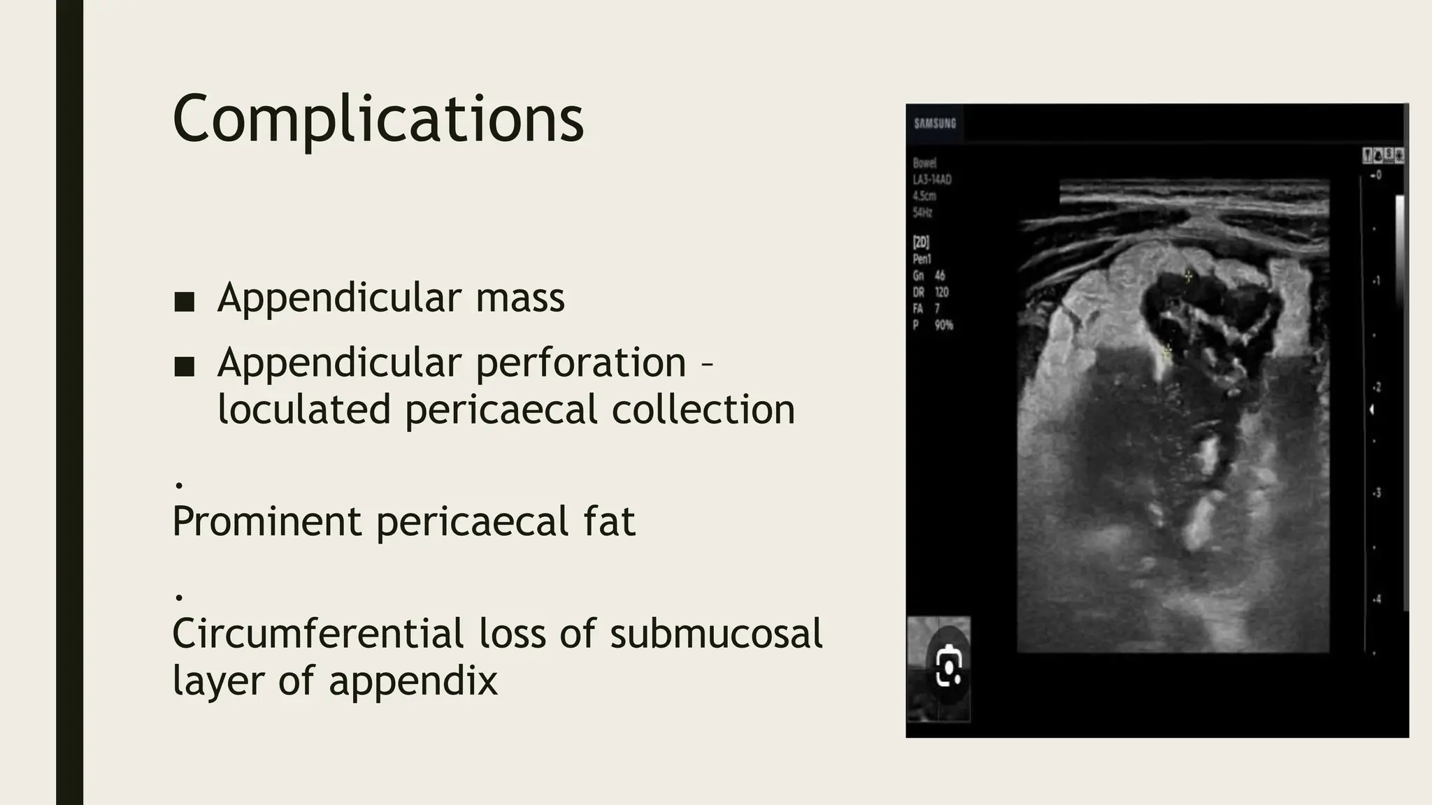 ACUTE ABDOMEN IMAGING 2.pptxACUTE ABDOMEN IMAGING 2.pptxACUTE ABDOMEN ...