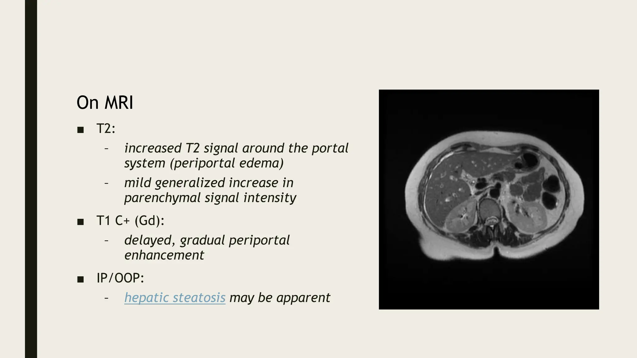 ACUTE ABDOMEN IMAGING 2.pptxACUTE ABDOMEN IMAGING 2.pptxACUTE ABDOMEN ...