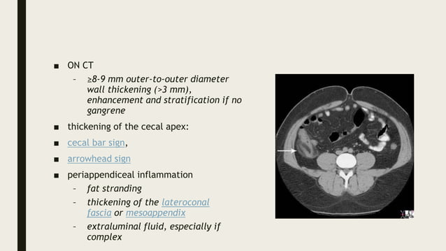ACUTE ABDOMEN IMAGING 2.pptxACUTE ABDOMEN IMAGING 2.pptxACUTE ABDOMEN ...