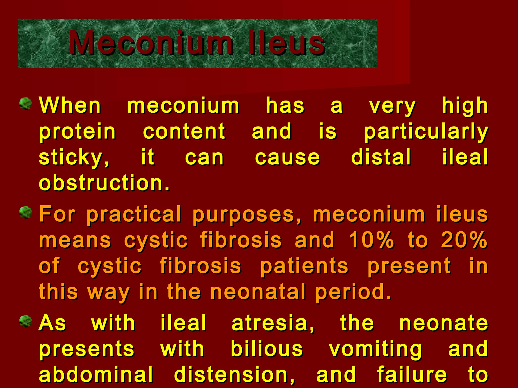 Acute abdomen in_pediatric | PPT