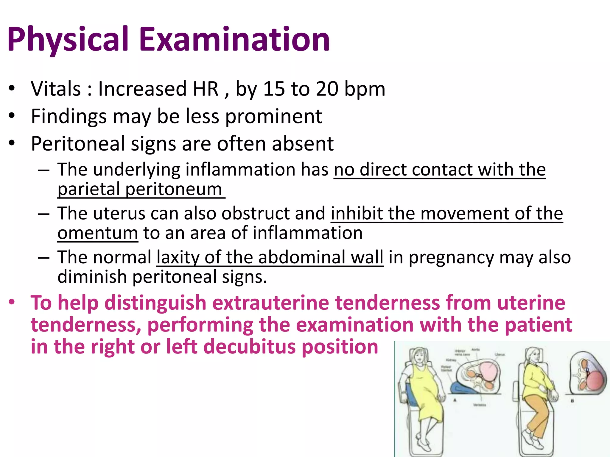 Acute abdomen in pregnancy | PPTX