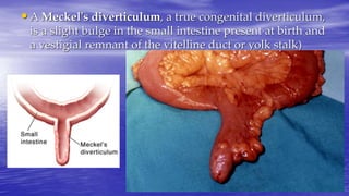 Acute Abdomen Intestinal Obstruction Peritonitis.pptx