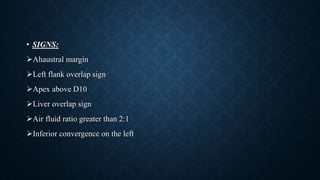 ACUTE ABDOMEN RADIOLOGICAL FINDINGS 3.pptx